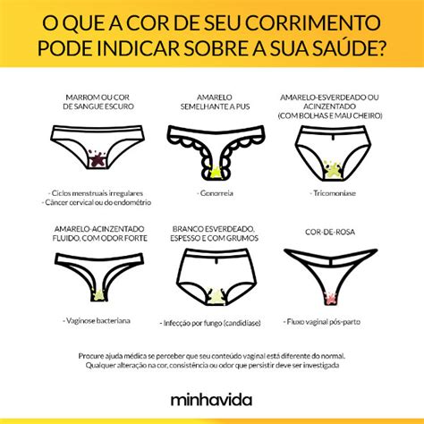 Corrimento Branco Por Que Ocorre Tratamento E Mais