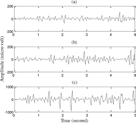 figure 3 from classification of eeg signals for detection of epileptic seizures based on