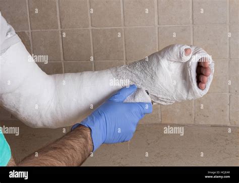 Is My Cast Plaster Or Fiberglass At Deanna Conway Blog