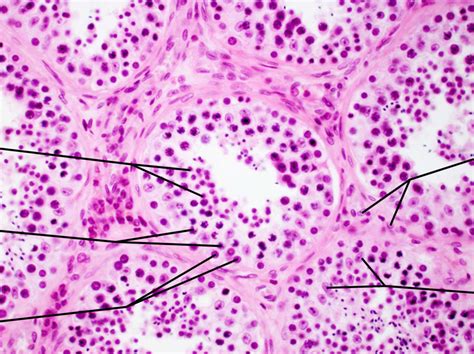 Histology Of Testis 2 Diagram Quizlet