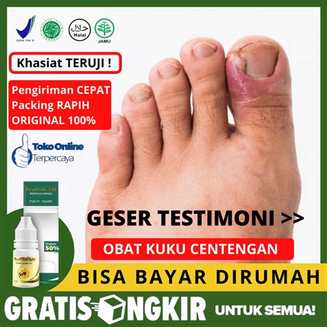 Cara Mengobati Jari Kaki Bengkak Bernanah Jempol Kaki Bengkak Ini 8