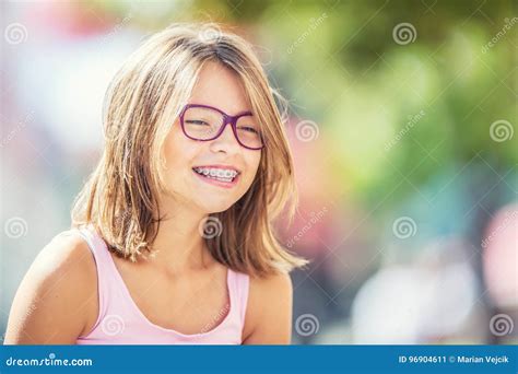 Happy Smiling Girl With Dental Braces And Glasses Young Cute Caucasian Blond Girl Wearing Teeth