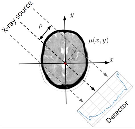 mathematics free full text tomographic reconstruction general approach to fast back