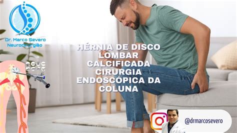 Cirurgia Endosc Pica Da Coluna Vertebral Para H Rnia De Disco Lombar