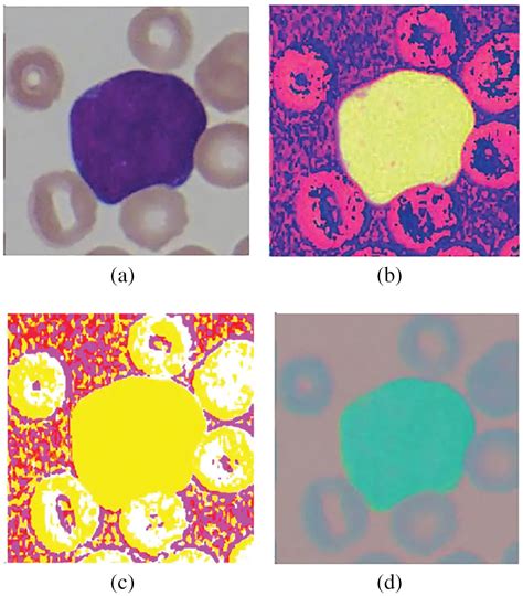 csse free full text automated leukemia screening and sub types classification using deep