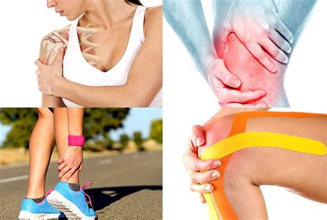 Tendinitis Causas S Ntomas Y Tratamiento La Gu A De Las Vitaminas
