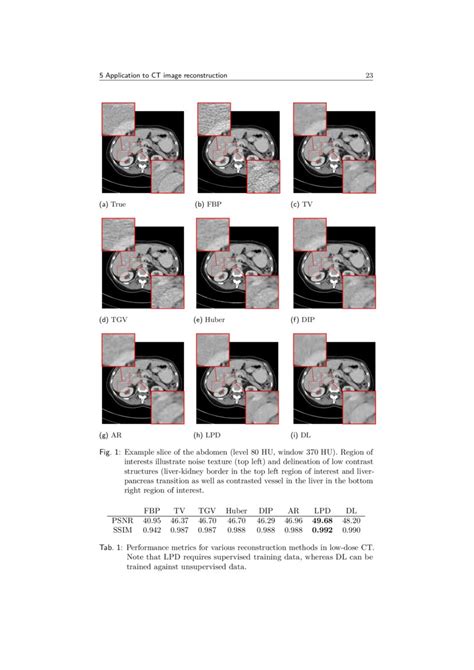 deep learning based dictionary learning and tomographic image reconstruction deepai