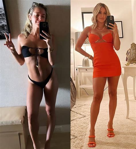 Kristin Cavallari Flaunts Her Sexy Legs In Black Stockings 4 Photos The Fappening