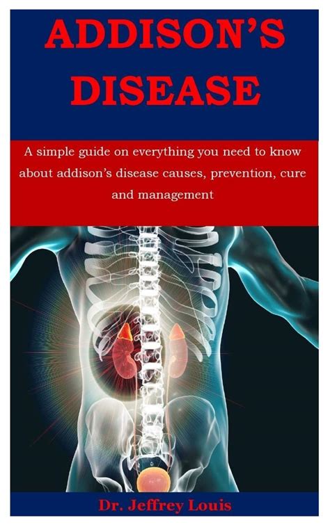 Buy Addison S Disease A Simple Guide On Everything You Need To Know