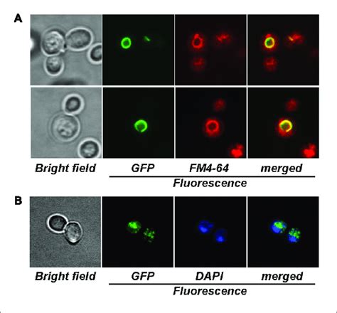 Visualization Of Yeasts Producing GFP Tagged AsCRD1 And AsCCC2 By