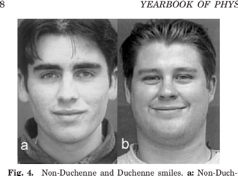 Duchenne Smile Vs Pan Am Smile