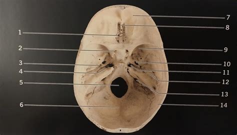 Cranial Cavity Superior View Diagram Quizlet