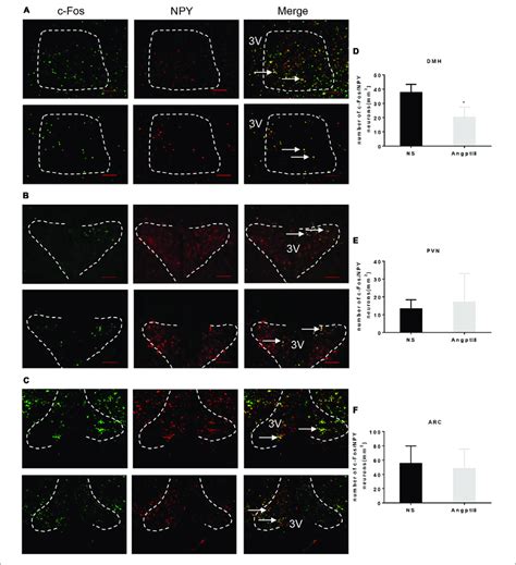 Double Staining Of C Fos And NPY In The Hypothalamic PVN DMH And