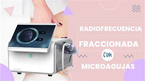 Radiofrecuencia Fraccionada Con Microagujas Youtube