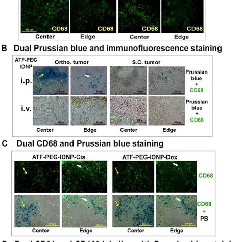 Development And Characterization Of UPAR Targeted Theranostic IONPs A
