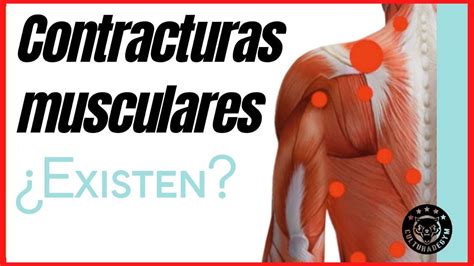 EXISTEN Las CONTRACTURAS MITO YouTube