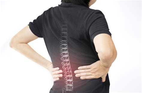 La Espondilitis Anquilosante y la quiropráctica SaludQuiropractica