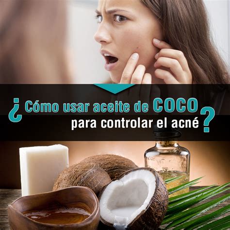 Cómo Usar El Aceite De Coco Para Controlar El Acné La Guía de las