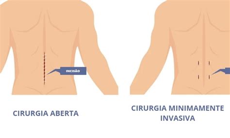 FIZ UMA CIRURGIA GRANDE NA CERVICAL E DEU TUDO CERTO E AS MAIORES