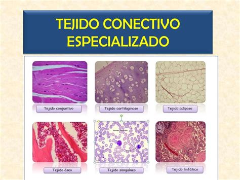 Tejido Conectivo Tipos NBKomputer