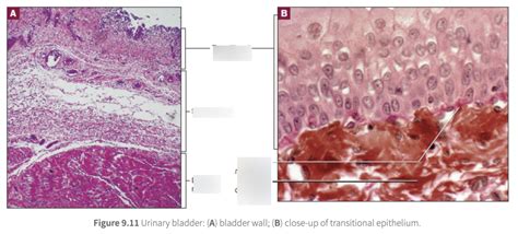 Urinary Bladder Histology Diagram Quizlet