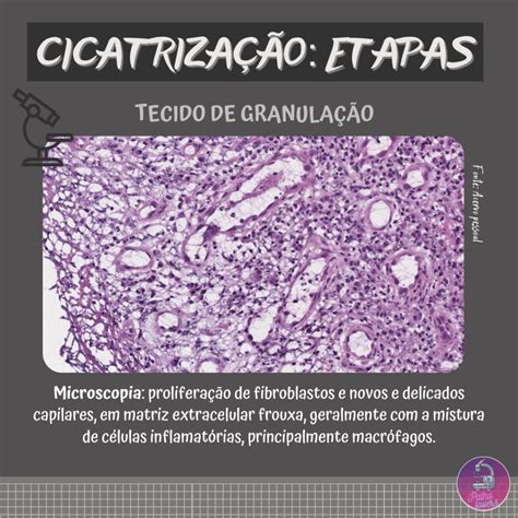 Reparo Tecidual Regeneração e Cicatrização PathoLovers