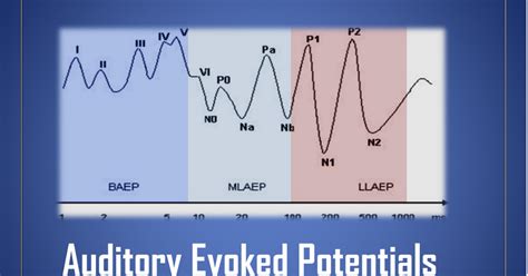 Auditory Evoked Potential Overview 1 Pdf Google Drive