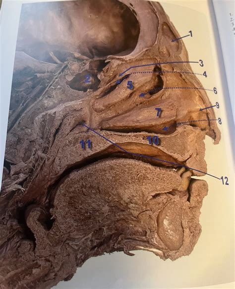 Nasal Cavity Diagram Quizlet