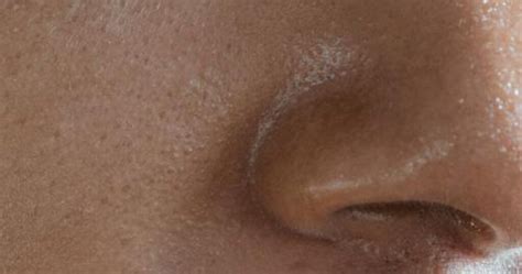 Rawat Blackhead Whitehead Ini Senarai Cleansing Oil Yang Boleh