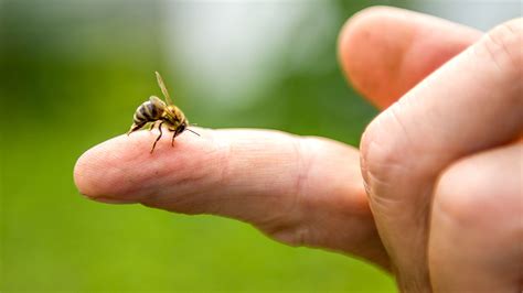 Qué debo hacer si me pica una abeja UnoTV