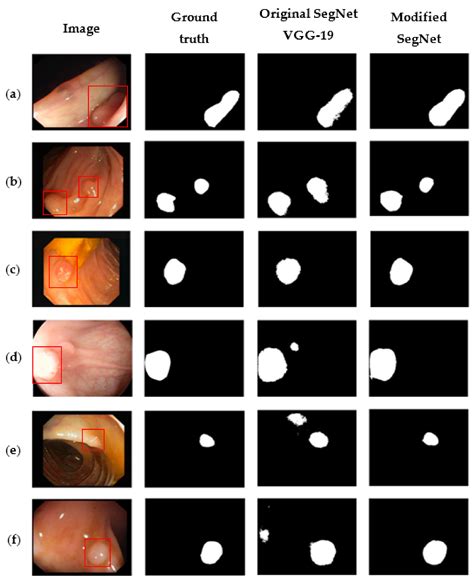 sensors free full text automatic polyp segmentation in colonoscopy images using a modified