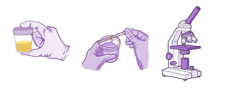 Urinalysis Uses Side Effects Procedure Results 52 OFF