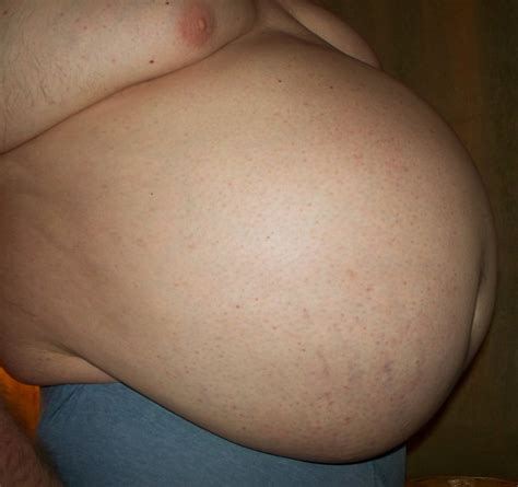 Obese Gainers And Feeders