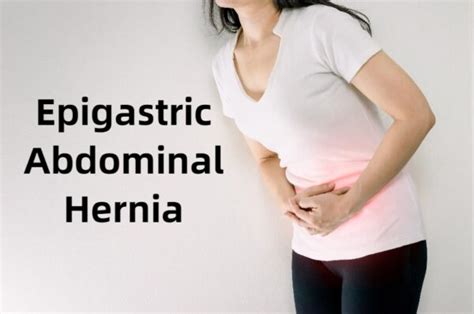An Epigastric Abdominal Hernia Symptoms For Female Dr Abhijit Gotkhinde