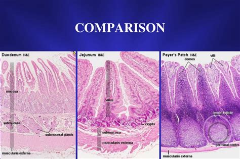 Duodenum Jejunum Ileum Comparison Google Search Germinal Center