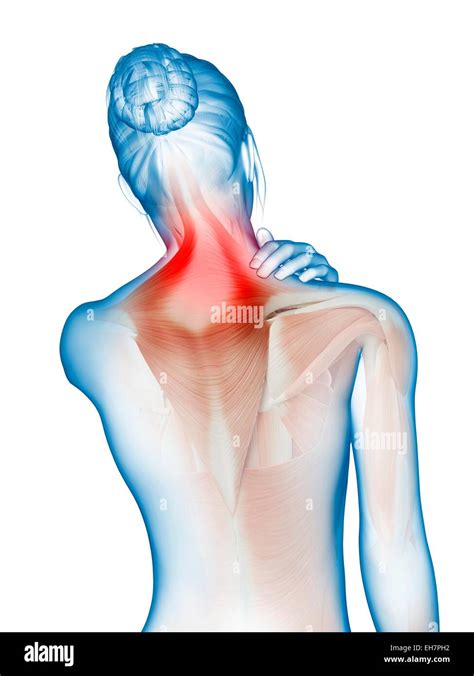 Human Neck Muscles Illustration Stock Photo Alamy