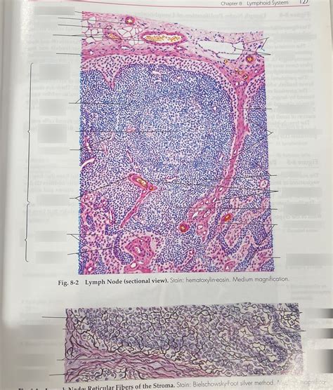 Lymph Node Diagram Quizlet
