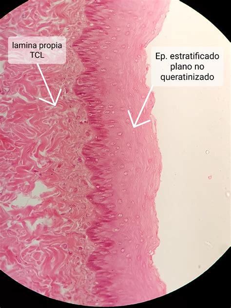 TP18 Histología del aparato digestivo Esófago Estómago