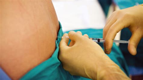 What Is An Epidural Health Choices First