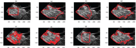 figure 10 from a fast level set curve flow formulation by logarithmic step size control for
