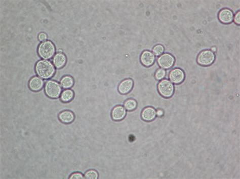 Saccharomyces Cerevisiae Under Microscope