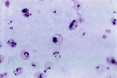 Free Picture Thick Film Photomicrograph Growing Plasmodium