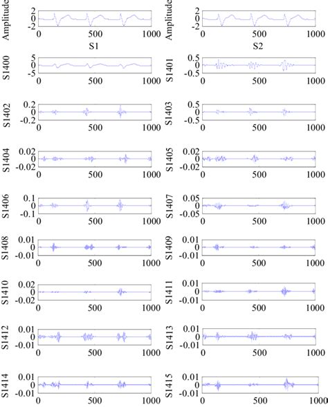 results of ecg signal decomposition using wpd s1 and s2 refer to the download scientific