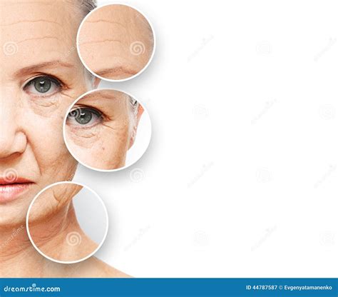 Invecchiamento Della Pelle Di Concetto Di Bellezza Procedure