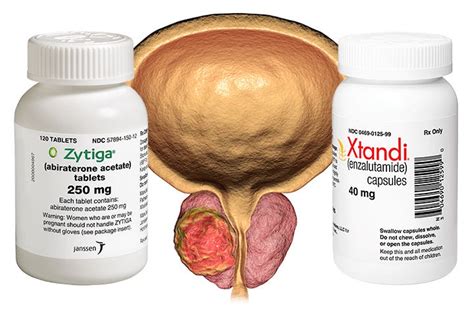 Newer Prostate Cancer Agents Not Free Of Heart Risk MedPage Today