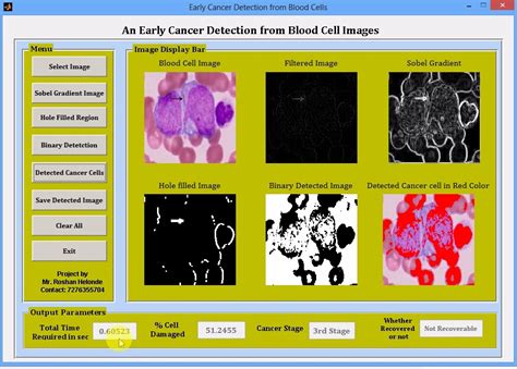 Blood Cancer Leukemia Detection Using Image Processing Matlab Project