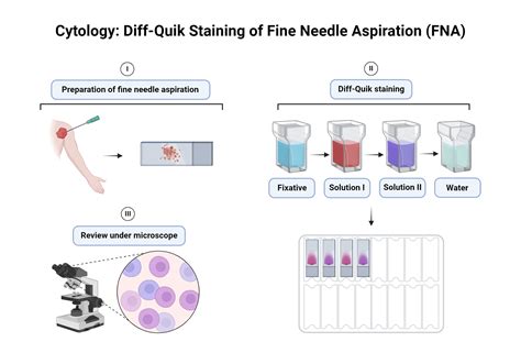 Cytology Diff Quik Staining Of Fine Needle Aspiration FNA