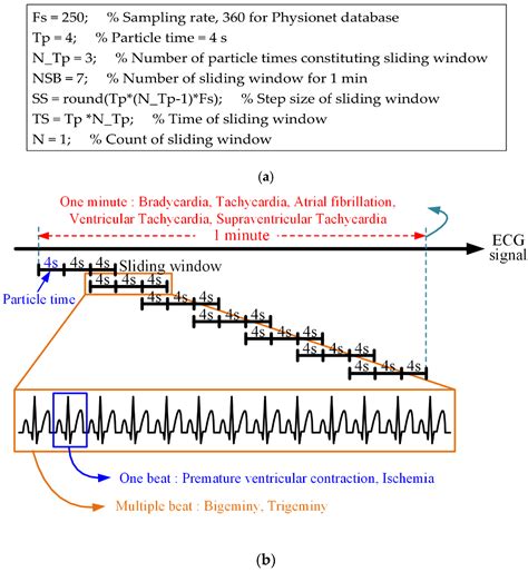 sensors free full text an adaptive median filter based on sampling rate for r peak detection