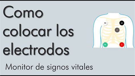 Como Colocar Los Electrodos Monitor De Signos Vitales Video 2