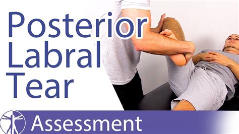 Hip Labral Tear Exercises